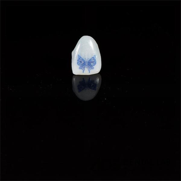 Quality High quality E-Max Fieldspathic Dental Veneer for sale