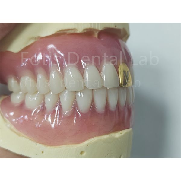 Quality Esthetics Complete Acrylic Denture Set Customizable Fit Easy To Clean for sale