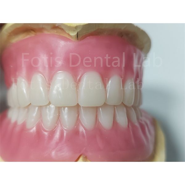 Quality Durable Natural Color Full Acrylic Denture Odorless Customization for sale