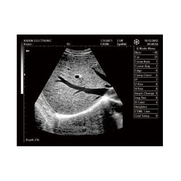 Quality Mobile Ultrasound Machine Digital Laptop Ultrasound Scanner with 100 Frames for sale