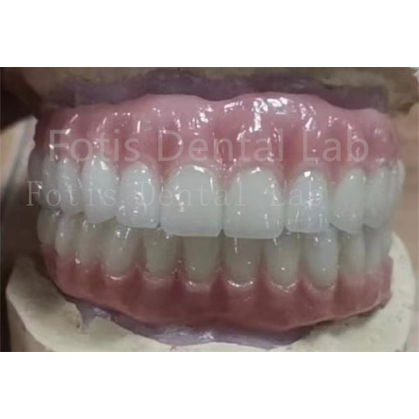 Quality Precise Fit Ivoclar Teeth Acrylic Complete Denture Stain Resistant for sale