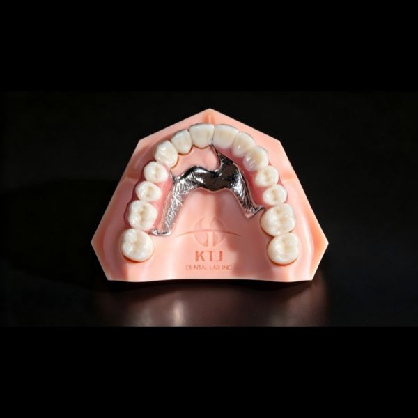Quality High Strength Titanium Crown And Bridge Coping With Composite for sale