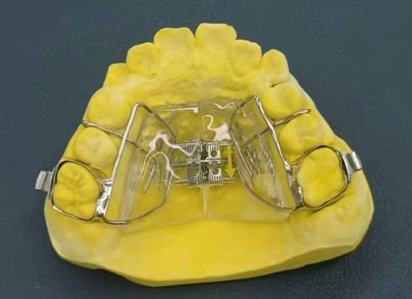 Quality Biocompatible and Clinically Proven Dental Expander - Custom-fitted Maxillary for sale