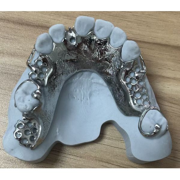 Quality Cast Partial Denture Framework for sale