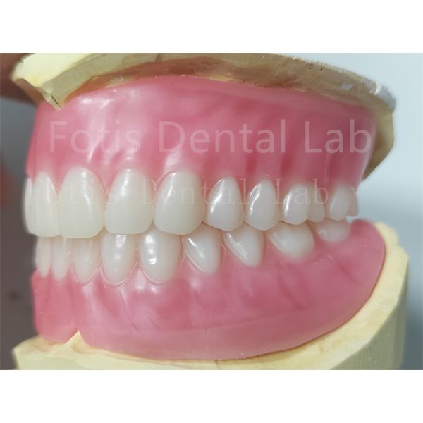 Quality OEM Full Upper And Lower Acrylic Denture Stain Resistance  Natural Color for sale