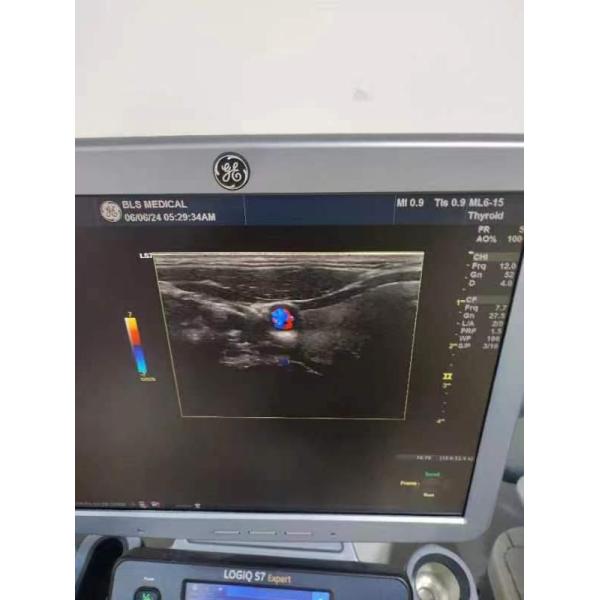 Quality Original Linear Array Ultrasound Machine Probes ML6-15 For GE LogiqP6 Ultrasound for sale