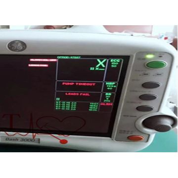 Quality 12.1 Inch 5 Parameter Patient Monitor , Dash3000 Healthcare Monitoring System for sale