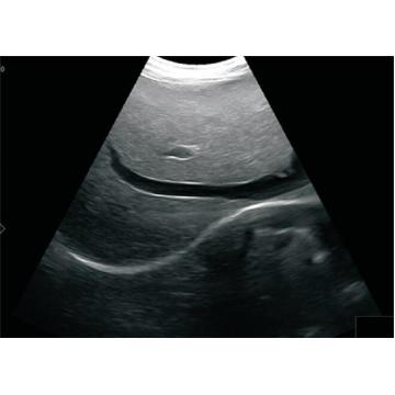 Quality 12 " LCD Screen Portable Ultrasound Device Digital High Resolution With B, B+B, for sale