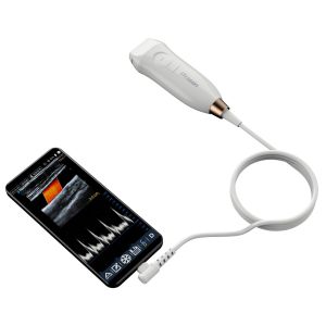 Quality Handheld Ultrasound Scanner with 12MHZ High Frequency Linear Probe for Accurate for sale