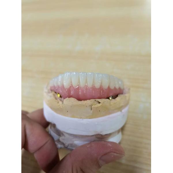 Quality Elevating Standards Our Dental Implant Crown Quality Assurance for sale