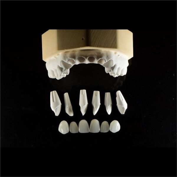 Quality Dental Lab Teeth Feldspathic Porcelain Veneers Custom Shaped for sale