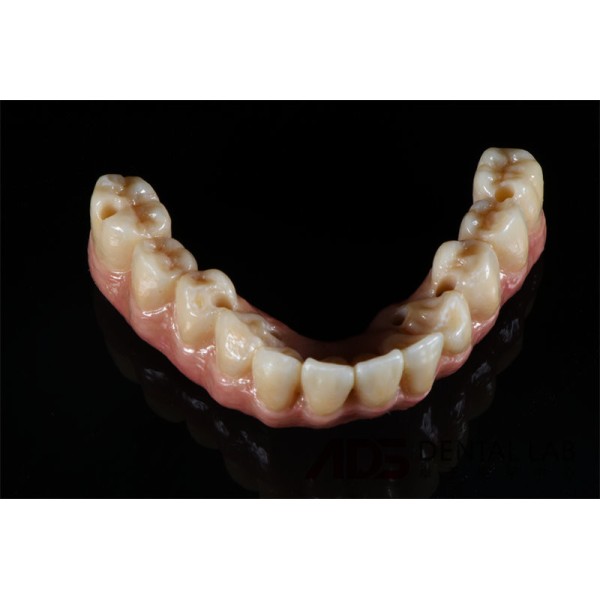 Quality OEM Cylindrical Titanium Full Bridge Dental Implants All On 4 6 for sale