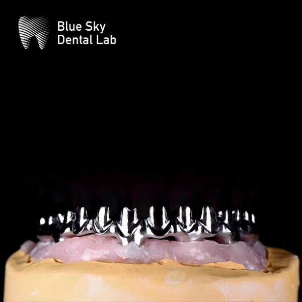 Quality Pure Titanium Metal Frame Dental Malo Bridges For Silver And Gold Frame Color for sale