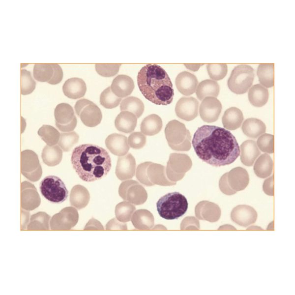 Quality Liu's Haematocyte Stain Kit For Classification Of Hematocytes for sale