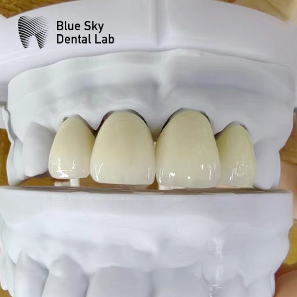 Quality Natural Looking Layered Zirconia High Strength Zircon Multilayer Rectangular for sale