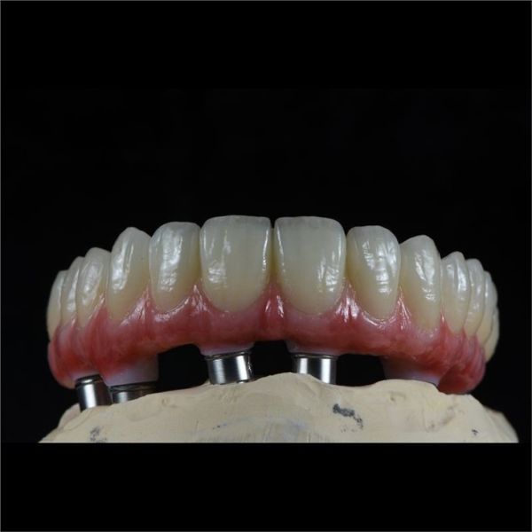 Quality Fixed Restorations Full Arch Zirconia Implant Bridge Denture Teeth for sale