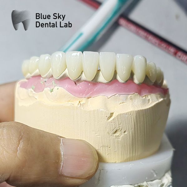 Quality Customized Surgical Smooth Steam Sterilization Universal Compatibility Implant procedure cases for sale