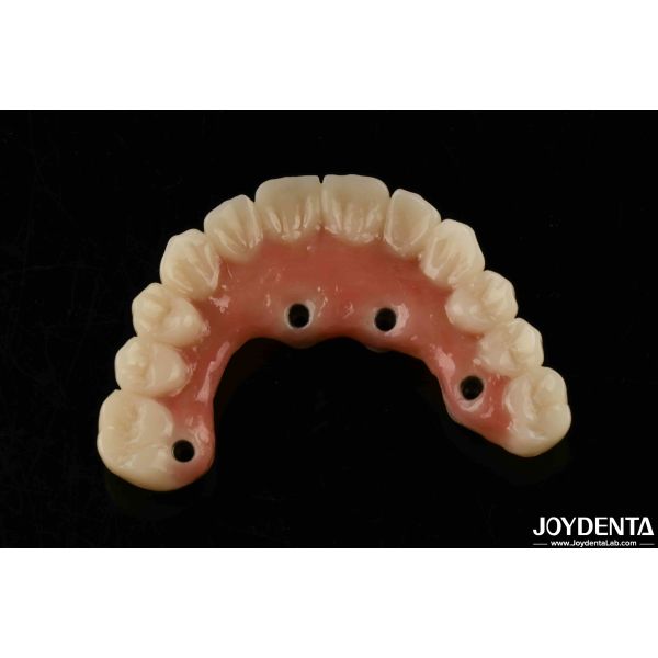 Quality Quick Drying Titanium Bar Acrylic Teeth Finishing Clear Acrylic Teeth Dental Supplies for sale