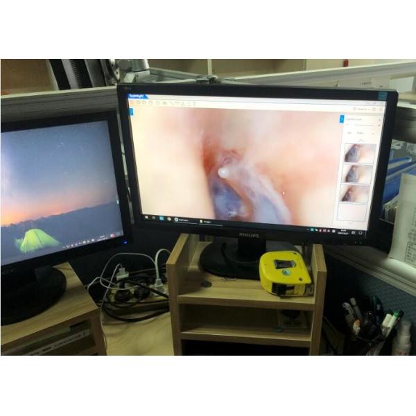 Quality 4mm Lens Diameter Focusable Portable Video Laryngoscope Waterproof for sale