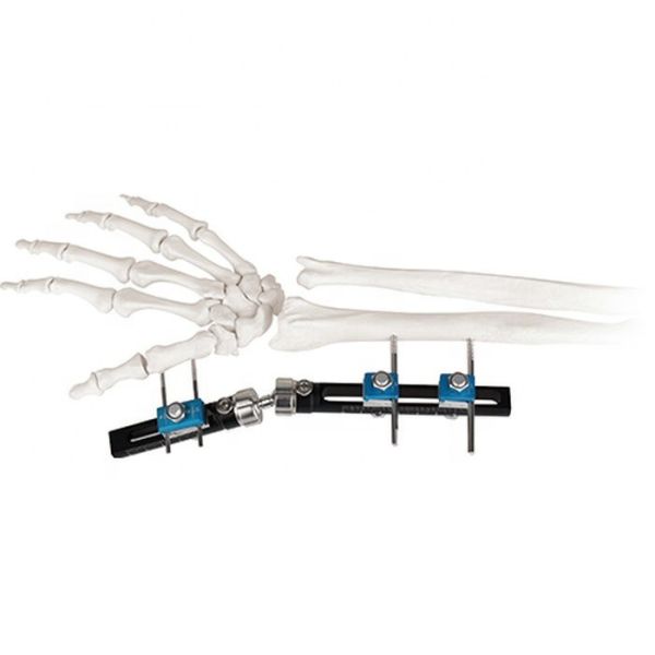 Quality Orthopedic Surgical External Fixation Device Wrist for sale