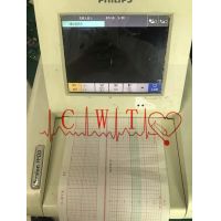 Quality 1366×768 3060mAh PHiliph FM20 ECG Replacement Parts 5 Parameters 3 Channel for sale