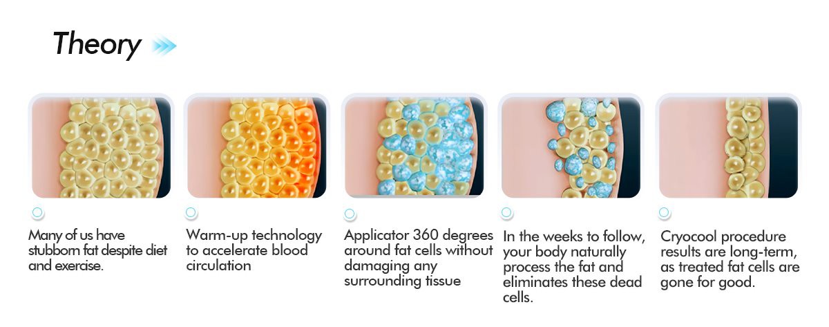 cryolipolysis slimming