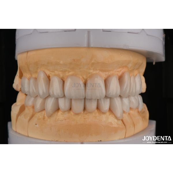 Quality High Translucency Layered Zirconia For Full Contour Dental Restorations for sale