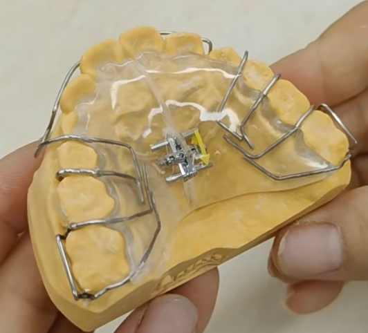 Quality Biocompatible and Clinically Proven Dental Expander - Custom-fitted Maxillary for sale