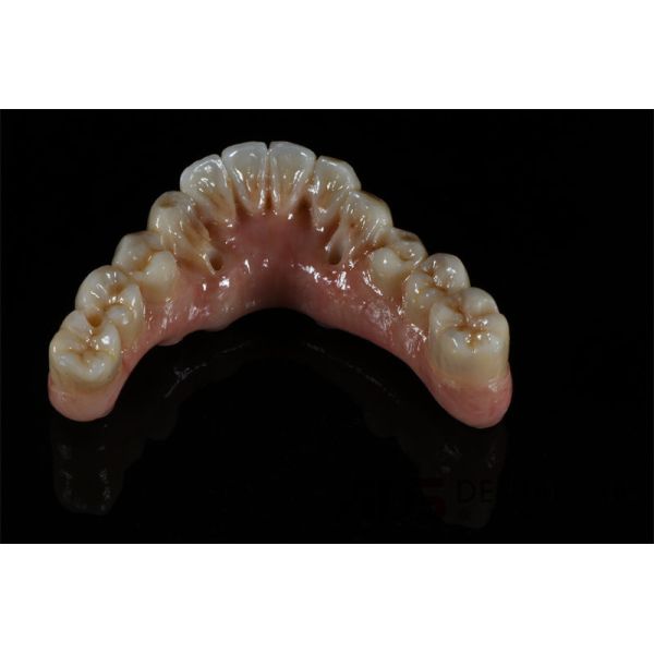Quality OEM Cylindrical Titanium Full Bridge Dental Implants All On 4 6 for sale