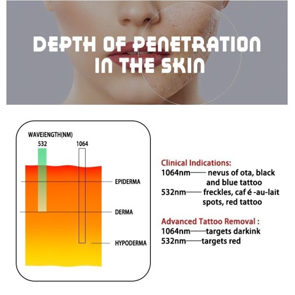 Quality Cooling System Closed-Off Water Circulation AI Pico Second Laser Tattoo Removal for sale