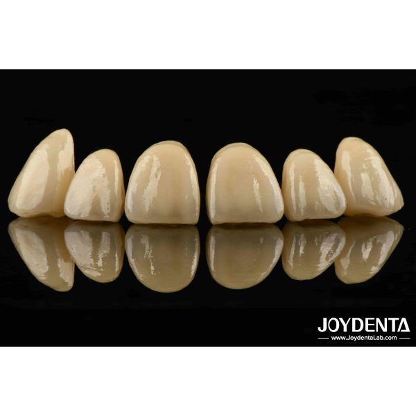 Quality Bionic Development Leaves And Distinct Layers Of Zirconia All-Ceramic for sale