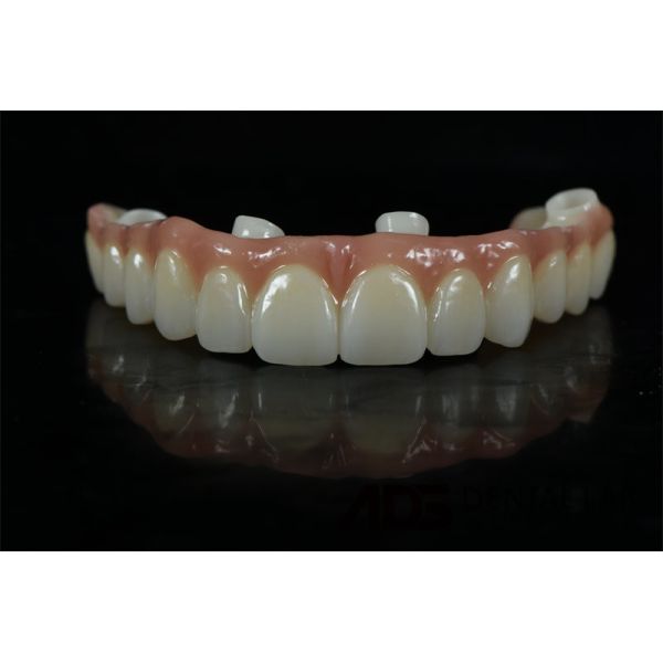 Quality Biocompatible Titanium All On 6 Dental Implants Bridge For Tooth for sale
