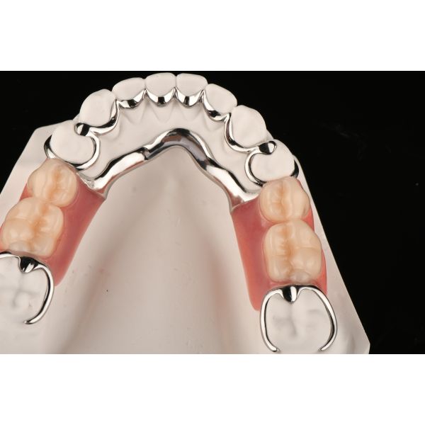Quality Stain Resistant Acrylic Partial Denture For Natural Comfort Replacing Missing for sale