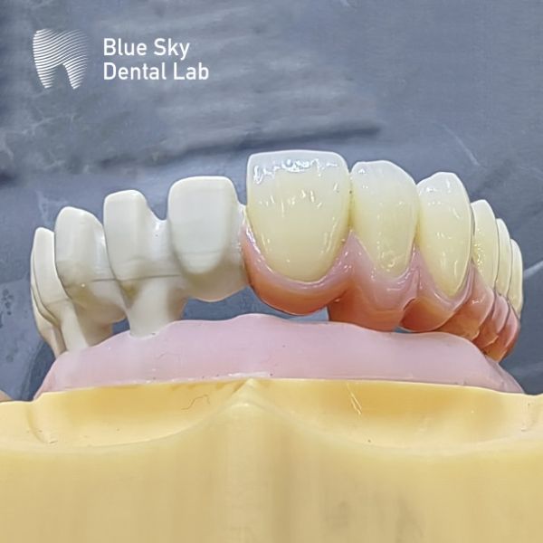 Quality Customize Color Implant Cases with Smooth Surface Nature Design for Universal for sale