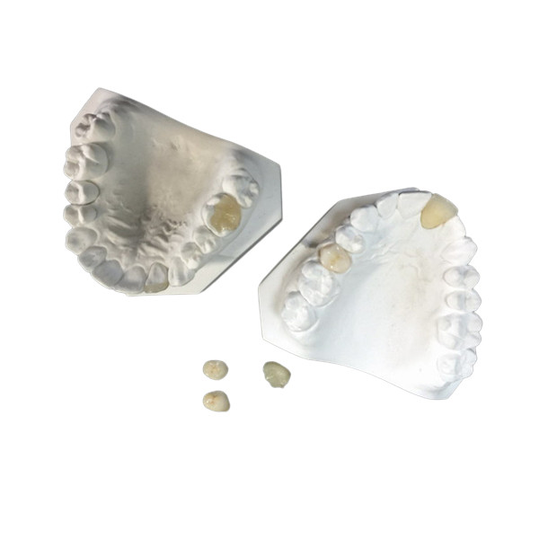 Quality Easy Maintain OEM White Ceramic Dental Crown Veneer Inlay Onlay for sale