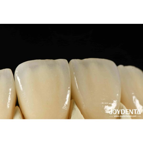 Quality Bionic Development Leaves And Distinct Layers Of Zirconia All-Ceramic for sale