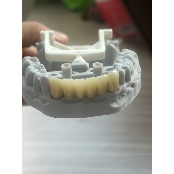 Quality CAD CAM milling technology enables zirconia dental restoration featuring natural tooth like appearance combined with high fracture toughness for sale