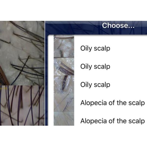 Quality Handhled Digital Skin Moisture And Oil Analyzer With Professional Software for sale