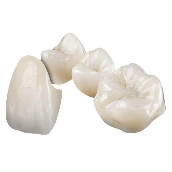 Quality Zirconia Dental Crown: Perfectly Fit, Natural Appearance for sale