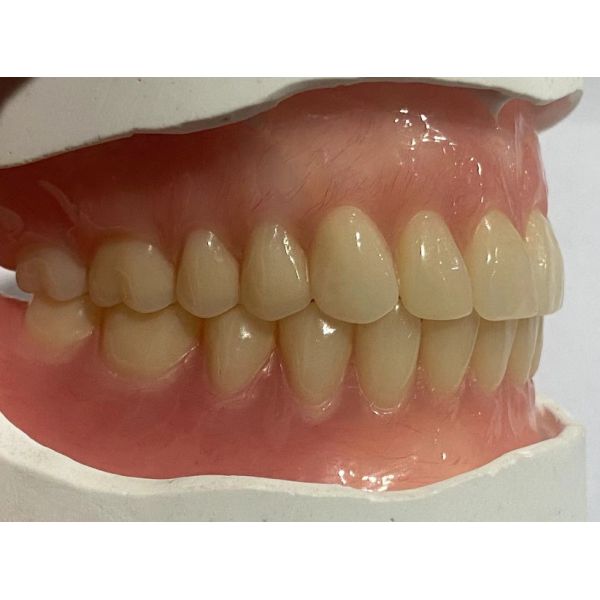 Quality Hypoallergenic Customized Removable Partial Denture With Pink Gum Color for sale