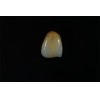 china ADS Dental Lab Dental Veneer Zirconia Stain Lifelike Finish OEM