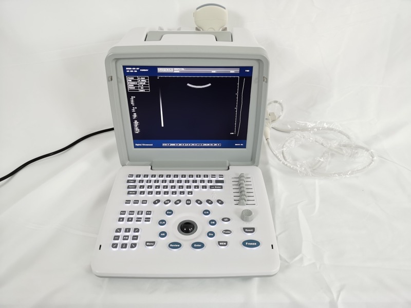 See Portable Pregnancy Laptop B W Scanner Wireless Fetal Doppler Probe Ultrasound Machine For Baby