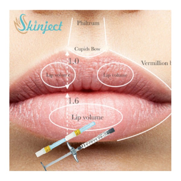 Quality Full Lip Cheek Injectable Dermal Filler Hyaluronic Acid HA Filler 1ml 2ml 5ml for sale
