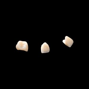 Quality Precise Fit Full Contour Zirconia Bridge Natural Zirconia Crown Bridge High for sale