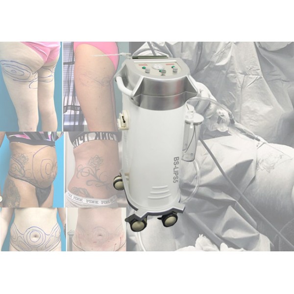 Quality Power Assisted Liposuction Machine Laser Liposuction for removing fat from body​ for sale