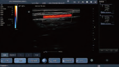 Mobile Phone Probe Wireless Ultrasound Probe Convex Linear Transvaginal Micro-convex Changeable Probe