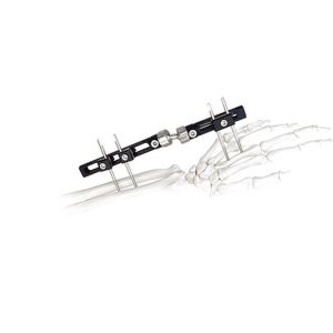 Quality Orthopedic Surgical External Fixation Device Wrist for sale
