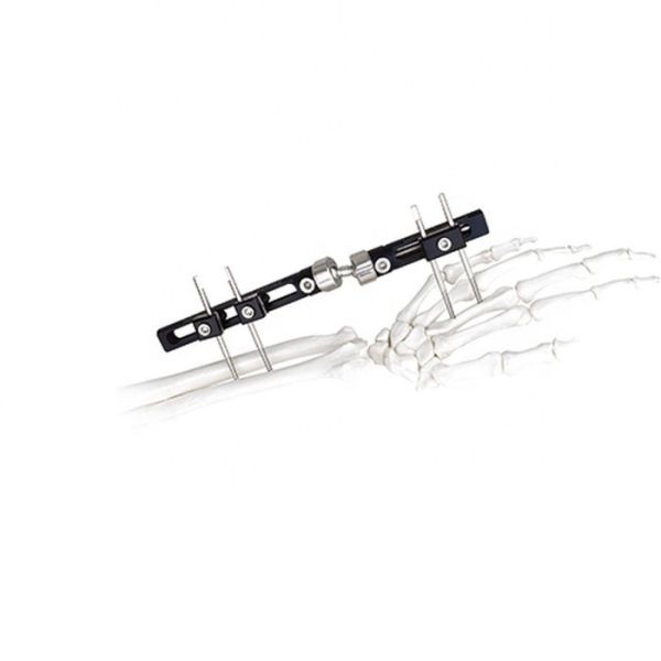 Quality Orthopedic Surgical External Fixation Device Wrist for sale
