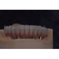 Quality Customizable Dental Implant Crowns For Natural Looking And Comfortable for sale
