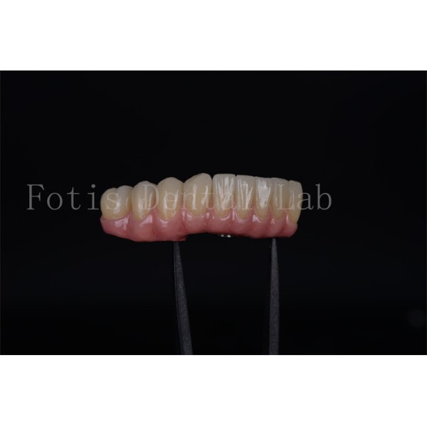 Quality Fast And Effective All On Four All On Six In A Day Implants Safety Ensured for sale